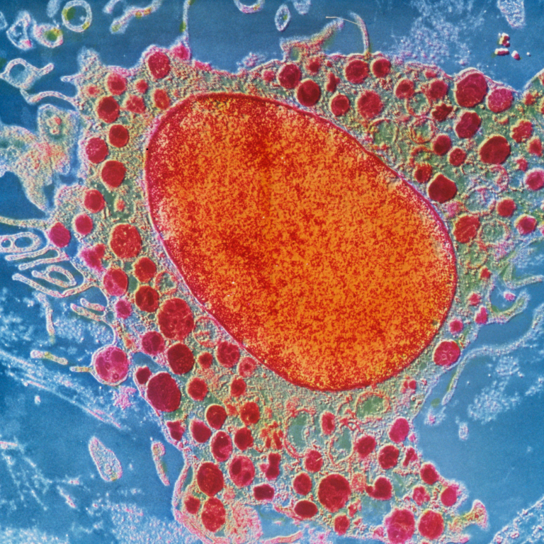 What are the Signs of Chronic Inflammation? | Flexx Chiropractic